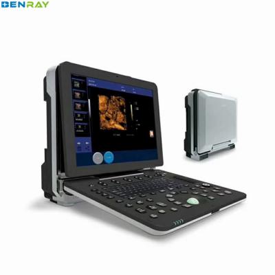 China Medical Ultrasound Device 4D Portable Color Doppler Machine for sale
