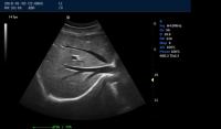 China Medical Ultrasound Device 4D Portable Color Doppler Machine for sale