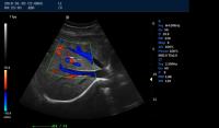 China Medical Ultrasound Device 4D Portable Color Doppler Machine for sale