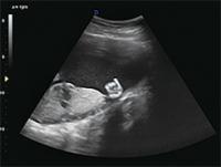 China Medical Ultrasound Device 4D Portable Color Doppler Machine for sale