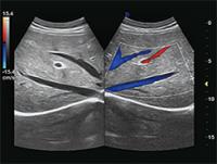 China Medical Ultrasound Device 4D Portable Color Doppler Machine for sale