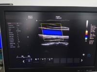 China Trolley color doppler Ultrasound Diagnostic System for sale