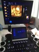 China Trolley color doppler Ultrasound Diagnostic System for sale