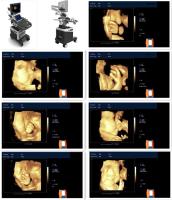 China Trolley color doppler Ultrasound Diagnostic System for sale