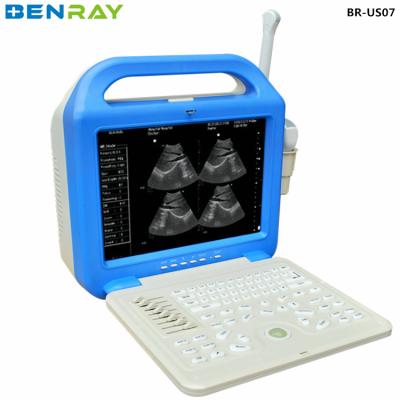 China Digital Laptop Ultrasonic  Diagnosis  Equipment to Human for sale