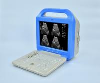 China Digital Laptop Ultrasonic  Diagnosis  Equipment to Human for sale