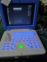 China Digital Laptop Ultrasonic  Diagnosis  Equipment to Human for sale