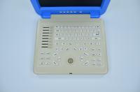 China Digital Laptop Ultrasonic  Diagnosis  Equipment to Human for sale