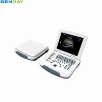 China Full-Digital Laptop Ultrasound Diagnostic System 96 Element for sale