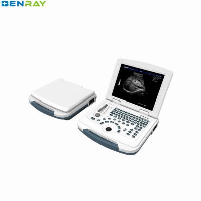 China Full-Digital Laptop Ultrasound Diagnostic System 96 Element for sale