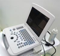 China Full-Digital Laptop Ultrasound Diagnostic System 96 Element for sale