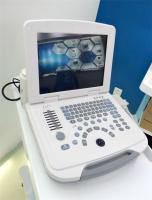 China Full-Digital Laptop Ultrasound Diagnostic System 96 Element for sale