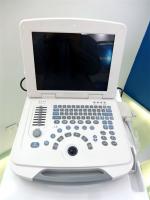 China Full-Digital Laptop Ultrasound Diagnostic System 96 Element for sale