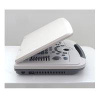 China Full-Digital Laptop Ultrasound Diagnostic System 96 Element for sale