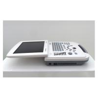 China Full-Digital Laptop Ultrasound Diagnostic System 96 Element for sale