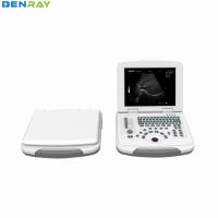 China Full-digital laptop Ultrasound Diagnostic System 80element for sale