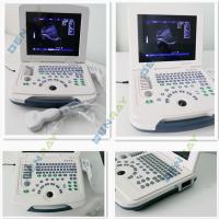 China Full-digital laptop Ultrasound Diagnostic System 80element for sale