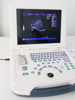 China Full-digital laptop Ultrasound Diagnostic System 80element for sale
