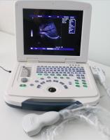 China Full-digital laptop Ultrasound Diagnostic System 80element for sale