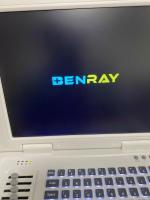 China Full-digital laptop Ultrasound Diagnostic System 80element for sale