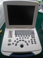 China Full-digital laptop Ultrasound Diagnostic System 80element for sale