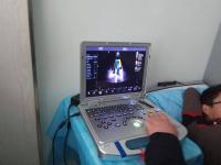 China 2D Portable color doppler machine for sale
