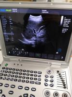 China 2D Portable color doppler machine for sale