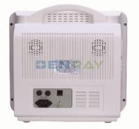 China 15'' Multi-Parameter Patient Monitor Surgical Medical Monitor Portable Patient Monitor for sale