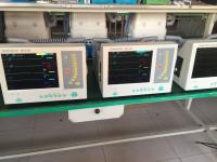 China Biphasic Defibrillator Monitor Portable Cardiac Defi-Monitor with 12 Lead ECG, NIBP for Hospital Emergency Use for sale