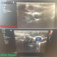 China L12-5 linear array ultrasound probe for repair for sale