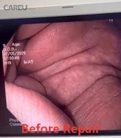 China OLYMPUS CF-H180AL Electronic Colonoscope For Repair for sale
