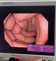 China OLYMPUS CF-H180AL Electronic Colonoscope For Repair for sale