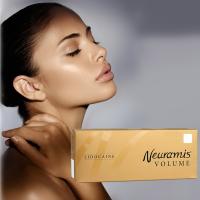 China Remove Wrinkle Neuramis Dermal Filler 24 - 48 Hours Recovery Time for sale