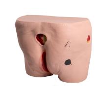 China Pressure Decubitus Ulcers Care Bedsores Nursing Manikin 4 Stage Wound Model for sale