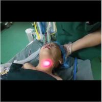 China Red Light Rigid Stylet Video Nasopharyngoscope 360mm Length 3.8mm Diameter Medical Intubation Equipment for sale