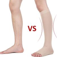 China Enerup Knee High Support Hose 20mmHg Open Toe Compression Socks For Women for sale