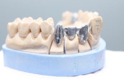 China High Yield Strength Dental Base Metal Alloys 12mm For Coping Bridge for sale