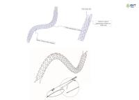 China Large Lumen Urethral Stent Hydrophobic Nitinol Design For Precision Placement for sale