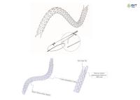 China Maximized Lumen URS Stent With Hydrophobic Nitinol Technology Anti Embedding Coating for sale