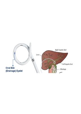 China Standard Pigtail Loop Biliary Drainage Catheter External Biliary Drainage with Platinum Marker One Click Lock for sale