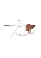 China Long Pigtail Loop Biliary Drainage Tube for Internal‑External Bile Drainage Medical Grade PU High Flow Design for sale