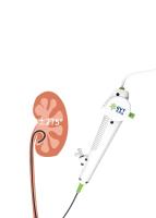 China Ultra-Slim Disposable Flexible Ureteroscope for Advanced Stone Management for sale