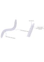 China Maximized Lumen URS Stent With Hydrophobic Nitinol Technology Anti Embedding Coating for sale
