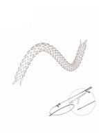 China Hydrophobic Ureteral Stent System with Nitinol Support and Enhanced Fatigue Resistance for sale