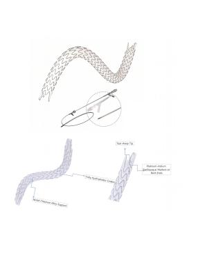 China High-Visibility Nitinol Ureteral Stent with Hydrophobic Coating and Large Flow Channel for sale