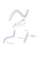 China Large-Lumen Nitinol Ureteral Stent with Hydrophobic Coating for Precision Placement for sale