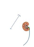China Dual Lumen Ureteral Access Sheath Endoscopic Procedures Access Sheath Urology for sale