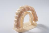 China Precise Bar Implant Supported Hybrid Denture Comfortable Fit Replace Missing Teeth for sale