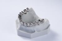 China Multiple Missing Teeth Implant Hybrid Prosthesis For Chewing And Speaking Restoration for sale