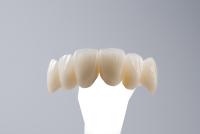 China Dental Porcelain Emax Laminate Veneers Thin Shell Natural Looking High Precision for sale